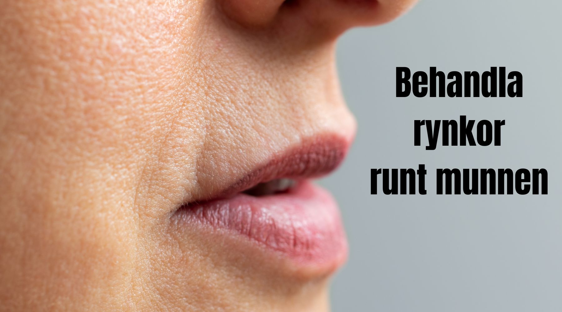 Rynkor runt munnen – rosalieve