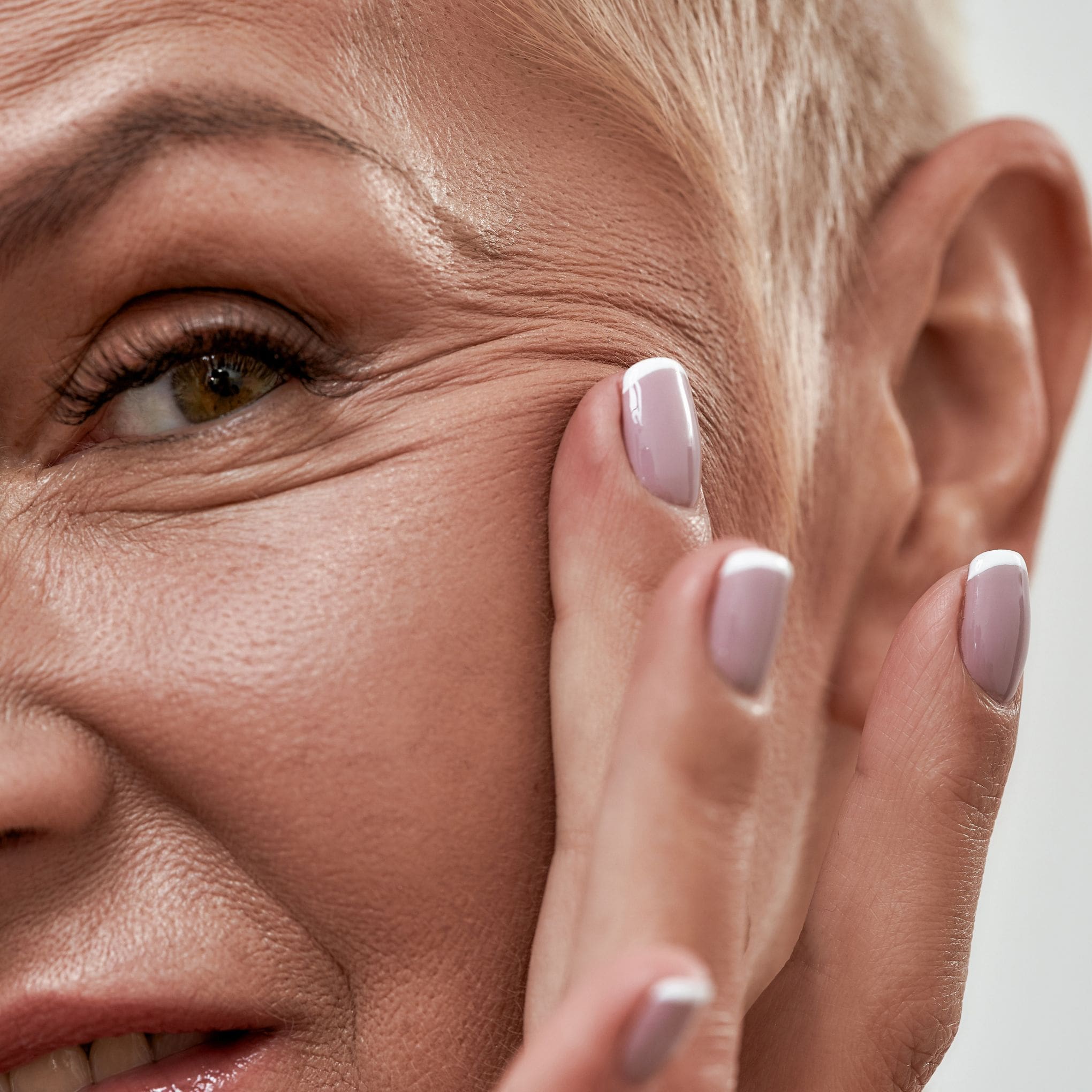 Rynkor under ögonen – rosalieve