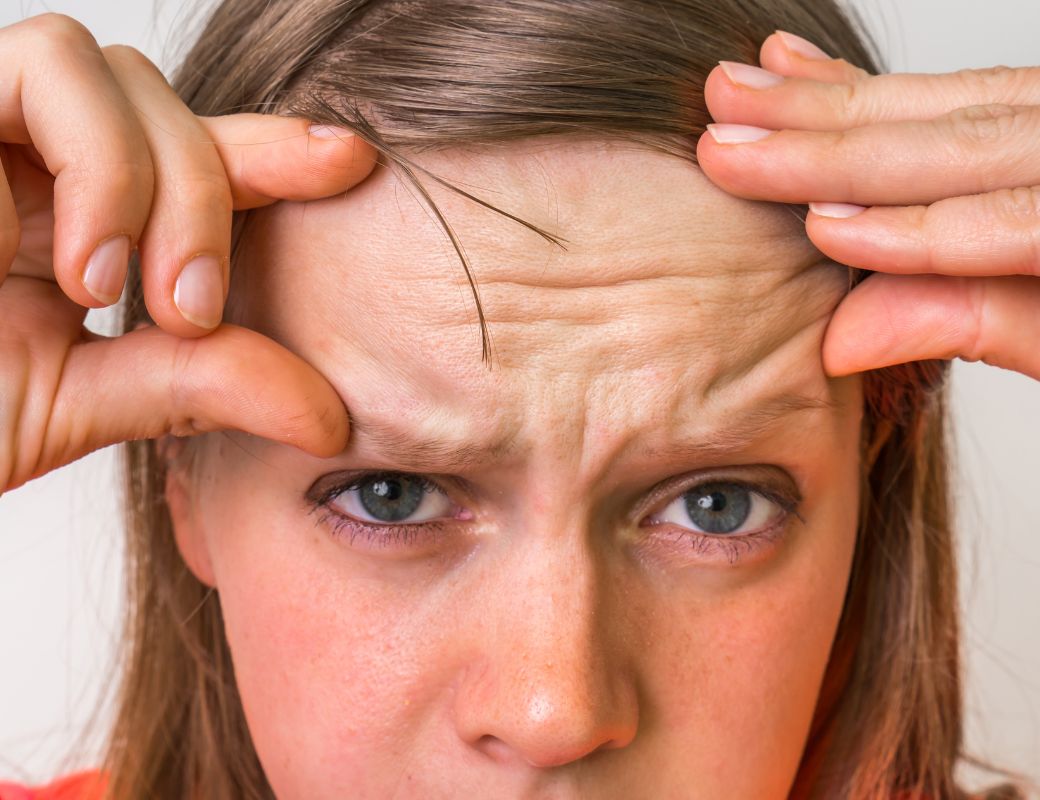 Rynkor i pannan – rosalieve